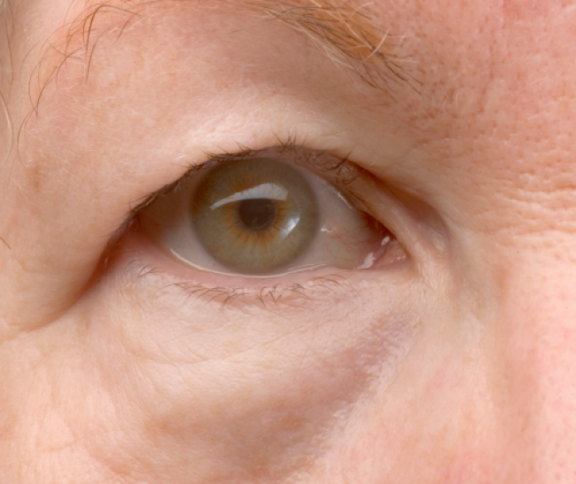 Die Augen | BeautyMed Akademie